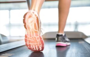 Common Treadmill Injuries & How To Avoid Them (Read Before Run ...